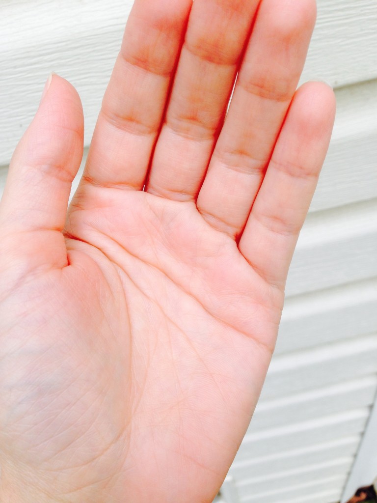 Hand Sani Causing Dry Hands? Try This! | Teacher Blog Spot